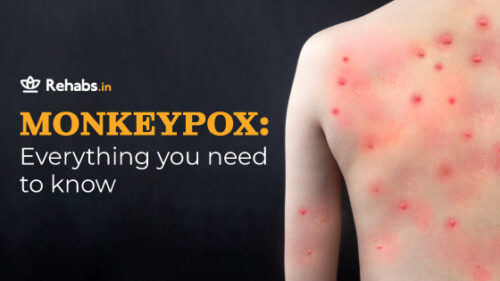 Monkeypox: Everything you need to know | Rehabs.in Rehabs.in